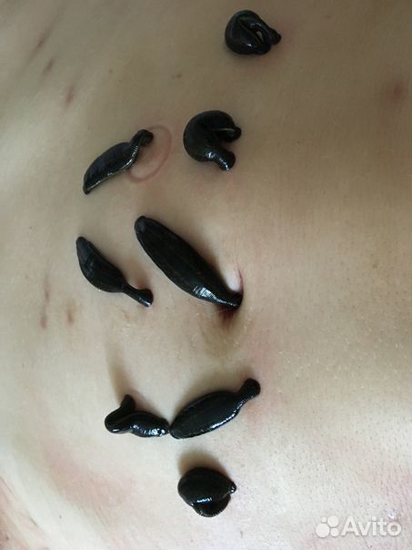 Продам пиявки в Крыму