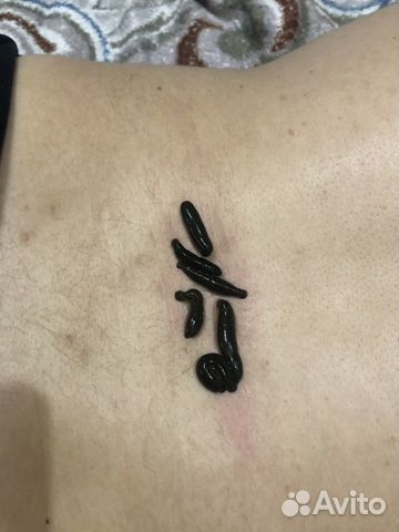 Пиявки медицинские